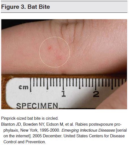 Epidemiology And Pathophysiology Mammalian Bites In The Emergency